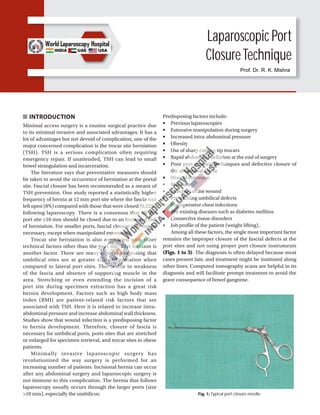 Laparoscopic Port Closure Technique | PDF