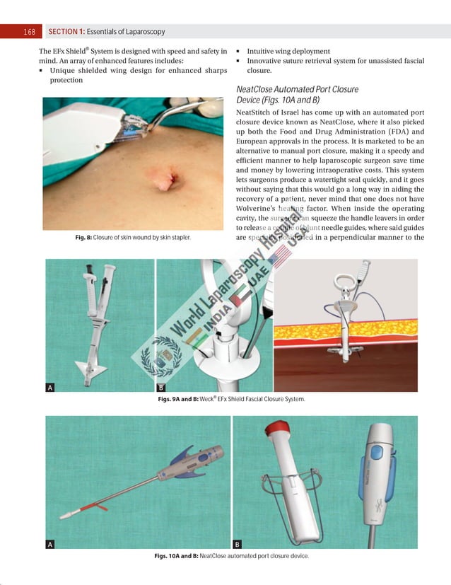 Laparoscopic Port Closure Technique | PDF