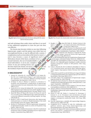 Laparoscopic Port Closure Technique | PDF