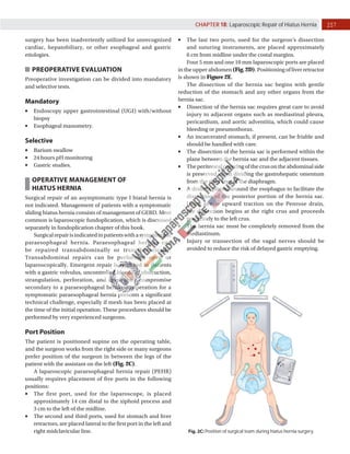 Laparoscopic Repair of Hiatus Hernia at WLH | PDF
