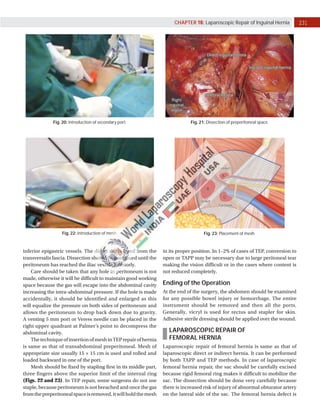 Laparoscopic Repair of Hiatus Hernia | PDF