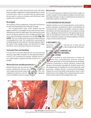 Laparoscopic Repair of Hiatus Hernia | PDF