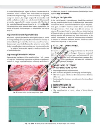Laparoscopic Repair of Hiatus Hernia | PDF