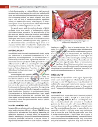 Laparoscopic Repair of Ventral Hernia at WLH | PDF