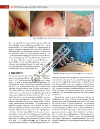 Laparoscopic Repair of Ventral Hernia at WLH | PDF