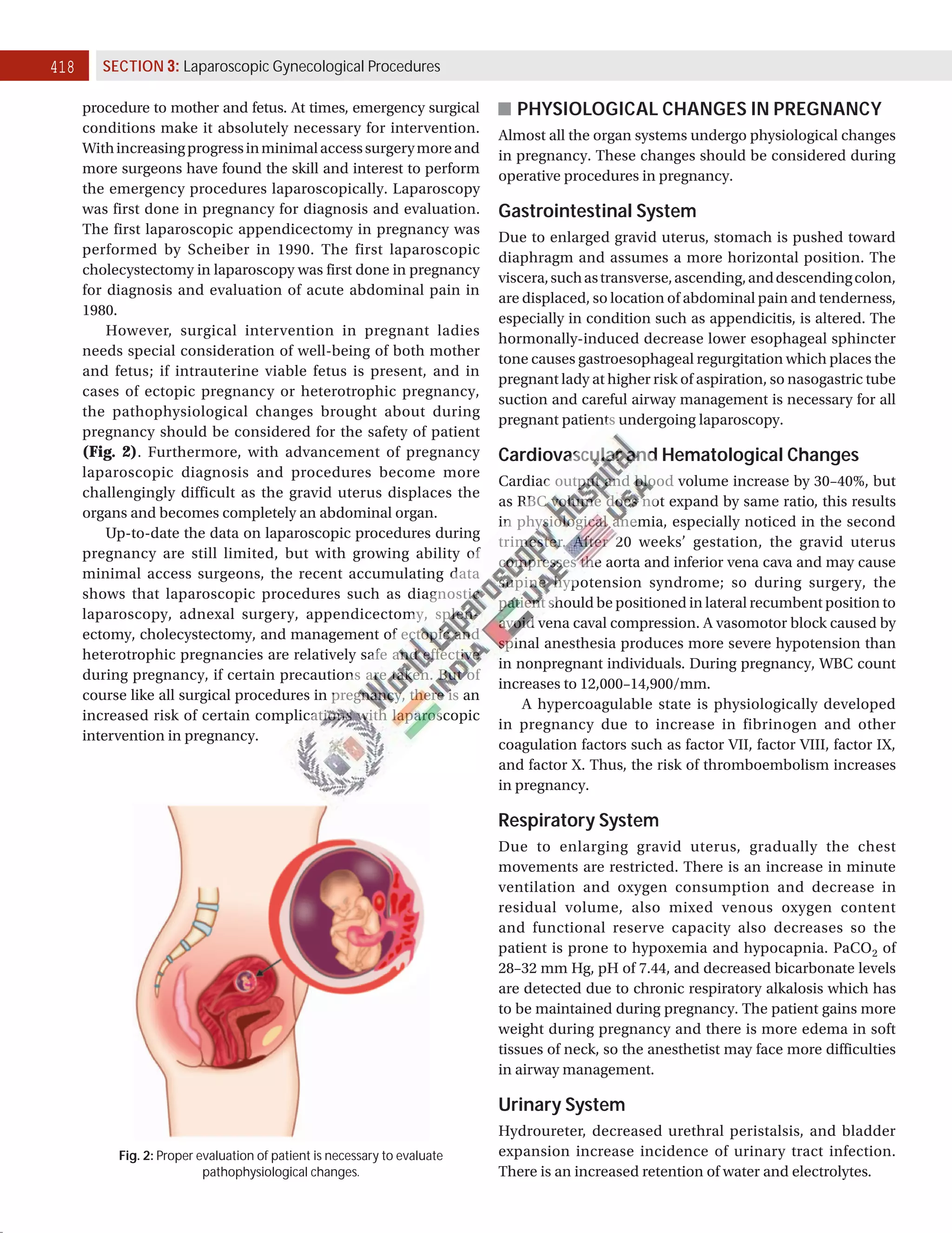 Laparoscopic Surgery in Pregnancy: Precautions and Complications | PDF