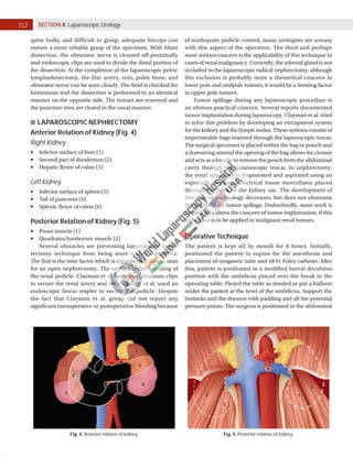 Laparoscopic Urological Procedures | PDF