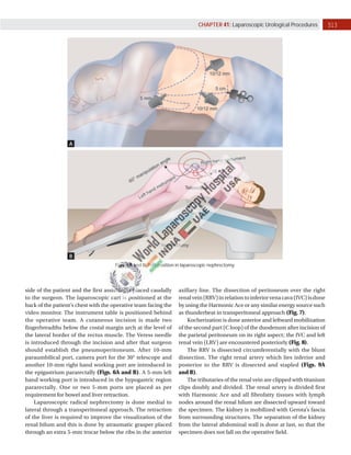Laparoscopic Urological Procedures at WLH | PDF