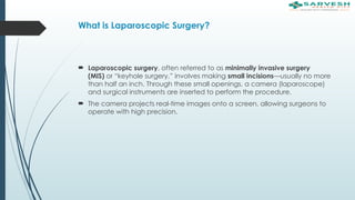 Laparoscopic vs. Open Surgery: Which One Should You Choose? | PPTX