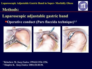 Laparoscopic Adjustable Gastric Band in Super Morbidly Obese Patients (BMI > 50) | PPT