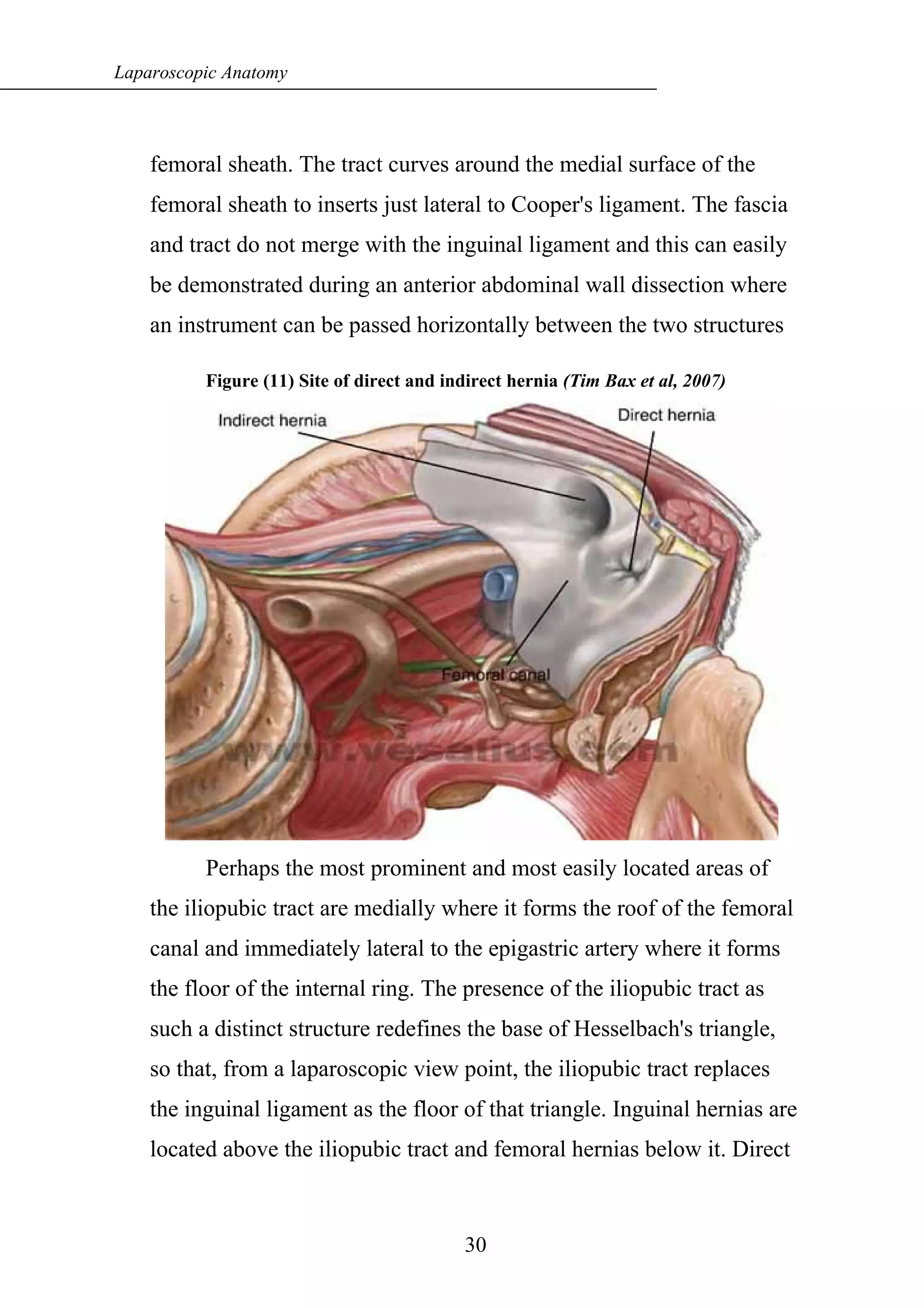 Laparoscopic anatomy of inguinal canal | DOC