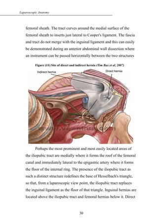 Laparoscopic anatomy of inguinal canal | DOC