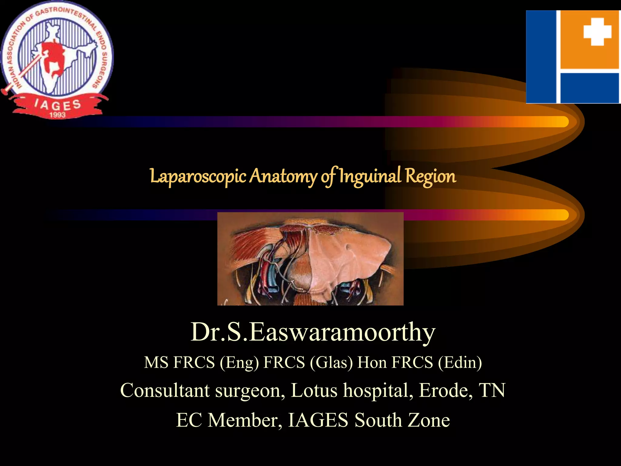 Laparoscopic anatomy of inguinal canal | PPTX