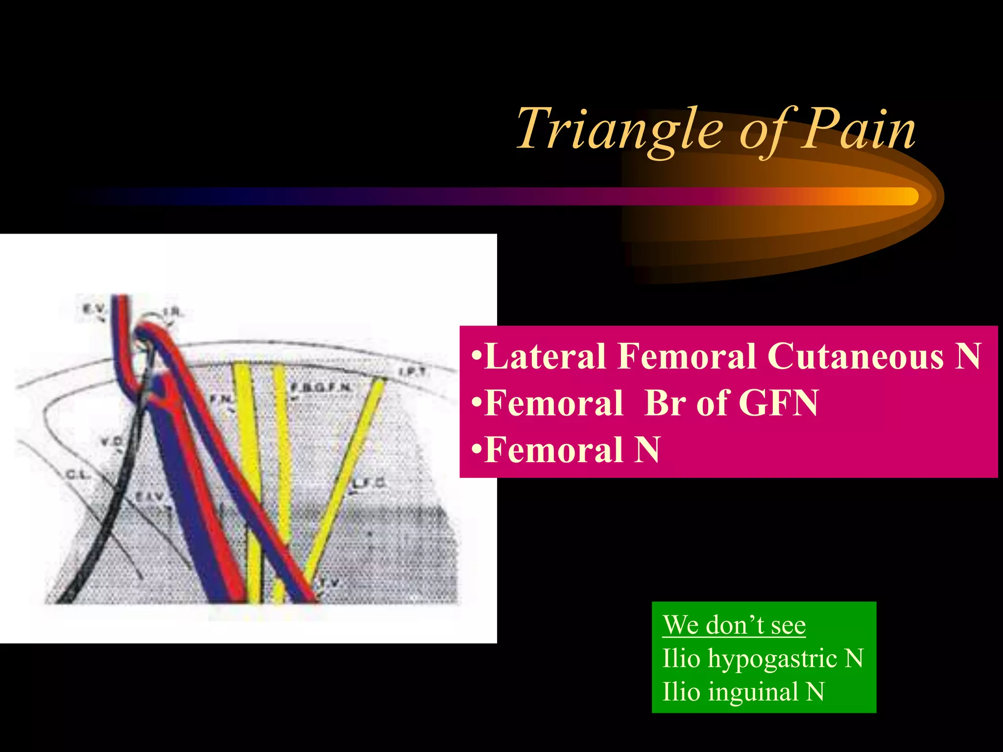 Laparoscopic anatomy of inguinal canal | PPTX
