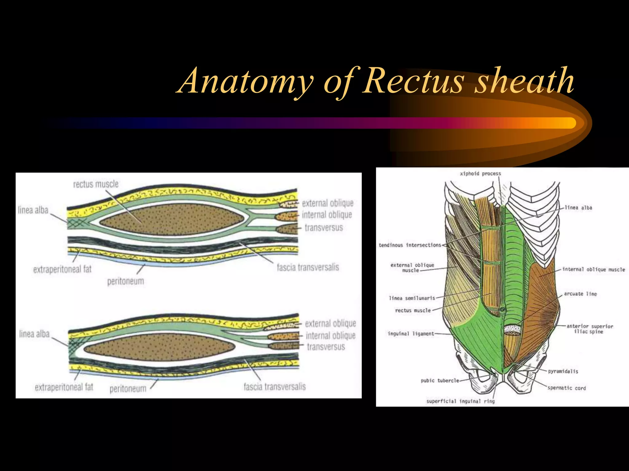 Laparoscopic anatomy of inguinal canal | PPTX