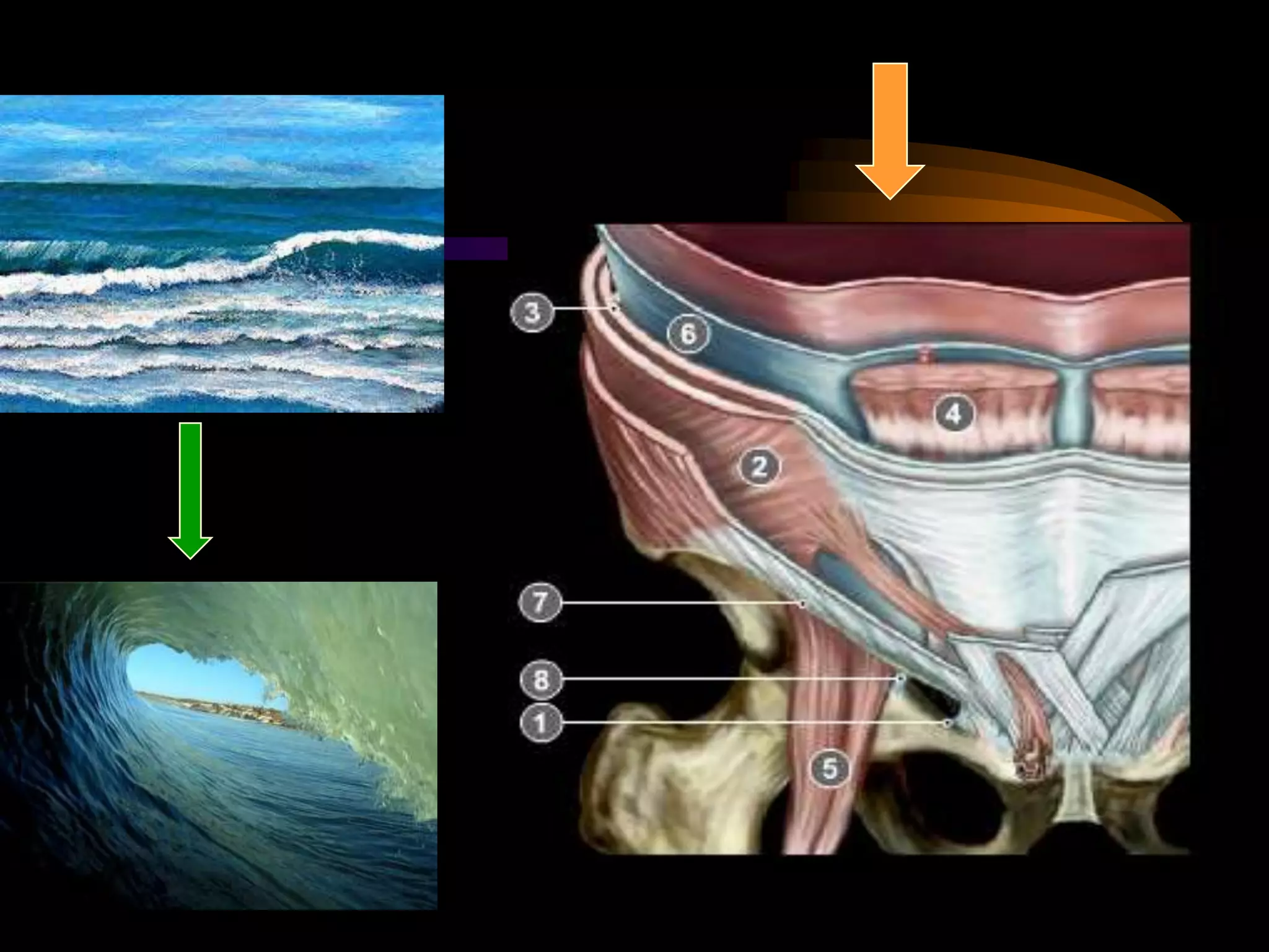 Laparoscopic anatomy of inguinal canal | PPTX