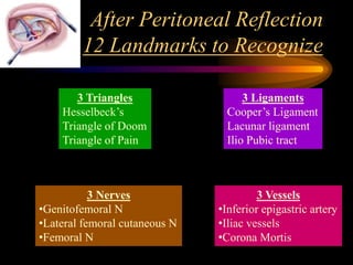 Laparoscopic anatomy of inguinal canal | PPT