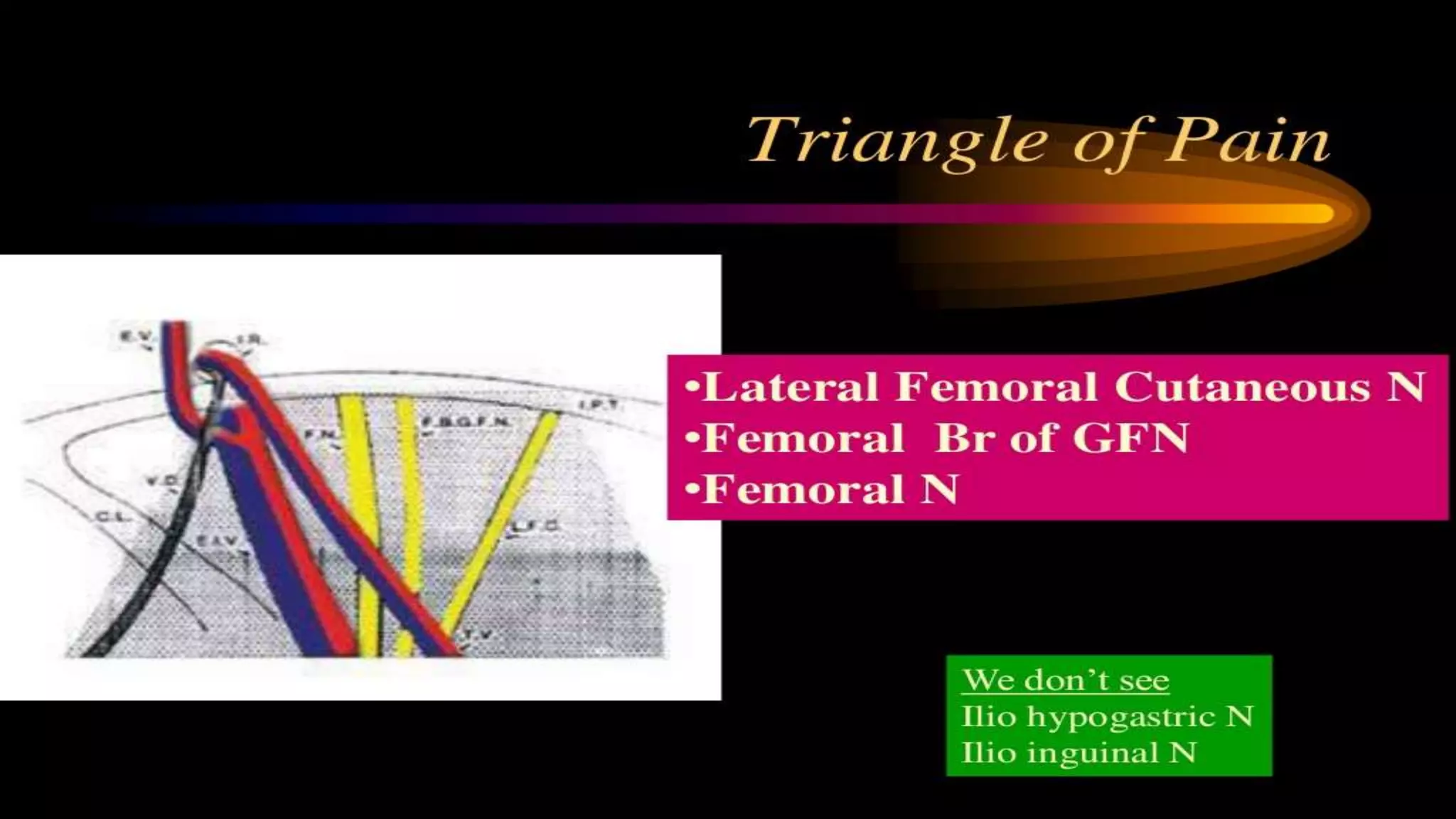 Laparoscopic anatomy of inguinal hernia | PPTX