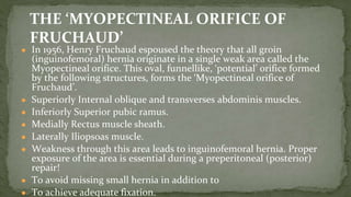 Laparoscopic anatomy of inguinal hernia | PPTX