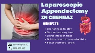 Laparoscopic Appendectomy in Chennai.pdf