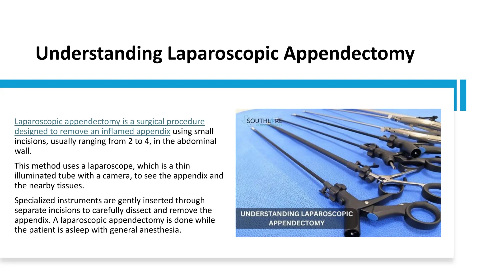 Laparoscopic Appendectomy Overview- By Dr Valeria Simone MD.pdf