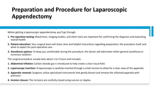 Laparoscopic Appendectomy Overview- By Dr Valeria Simone MD.pdf