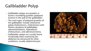 Laparoscopic cholecystectomy | PPTX