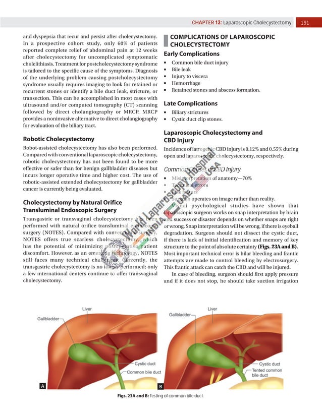 Laparoscopic Cholecystectomy | PDF