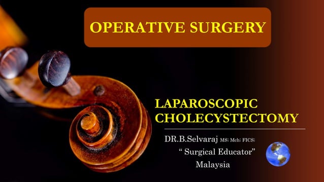 Laparoscopic cholecystectomy/ operative surgery | PPTX