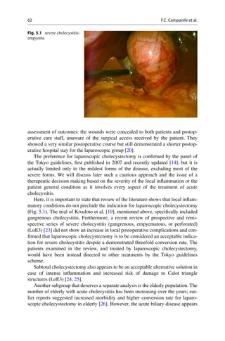 Laparoscopic Cholecystectomy_ An Evidence-Based Guide ( PDFDrive ).pdf