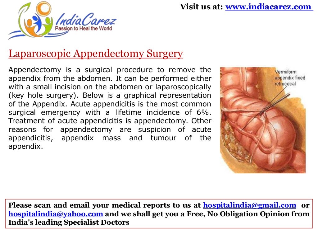 Laparoscopic cholecystectomy appendicectomy in india