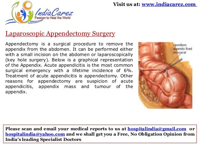 Laparoscopic cholecystectomy appendicectomy in india