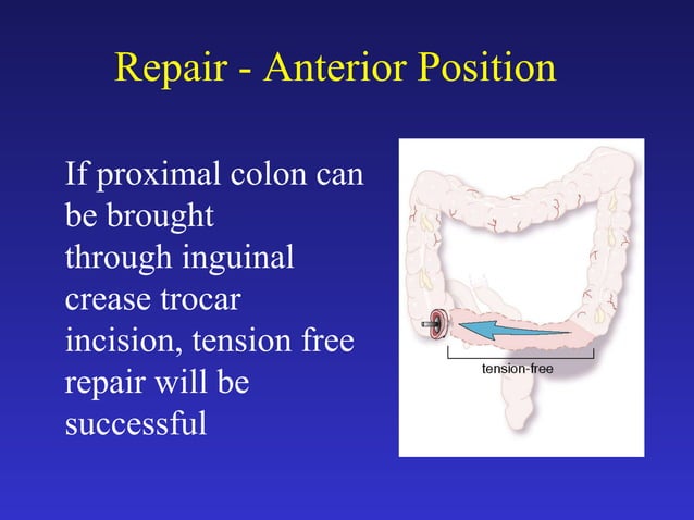 Laparoscopic Colon Resection - Anterior Approach | PPT