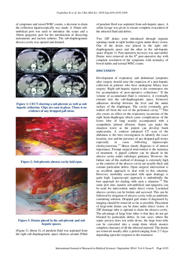 Laparoscopic drainage of subphrenic abscess