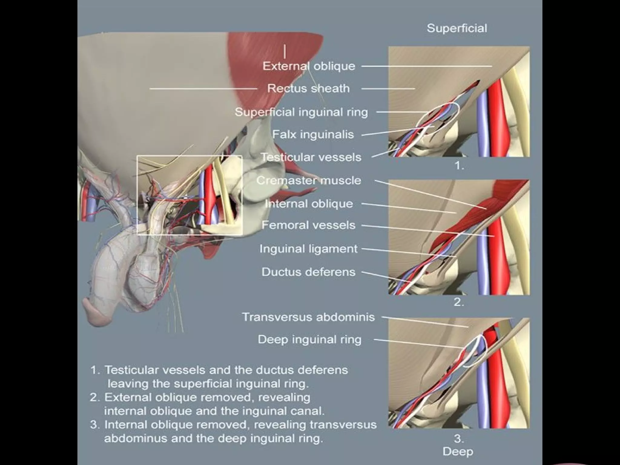 Laparoscopic groin hernia repair anatomy & technique | PPT