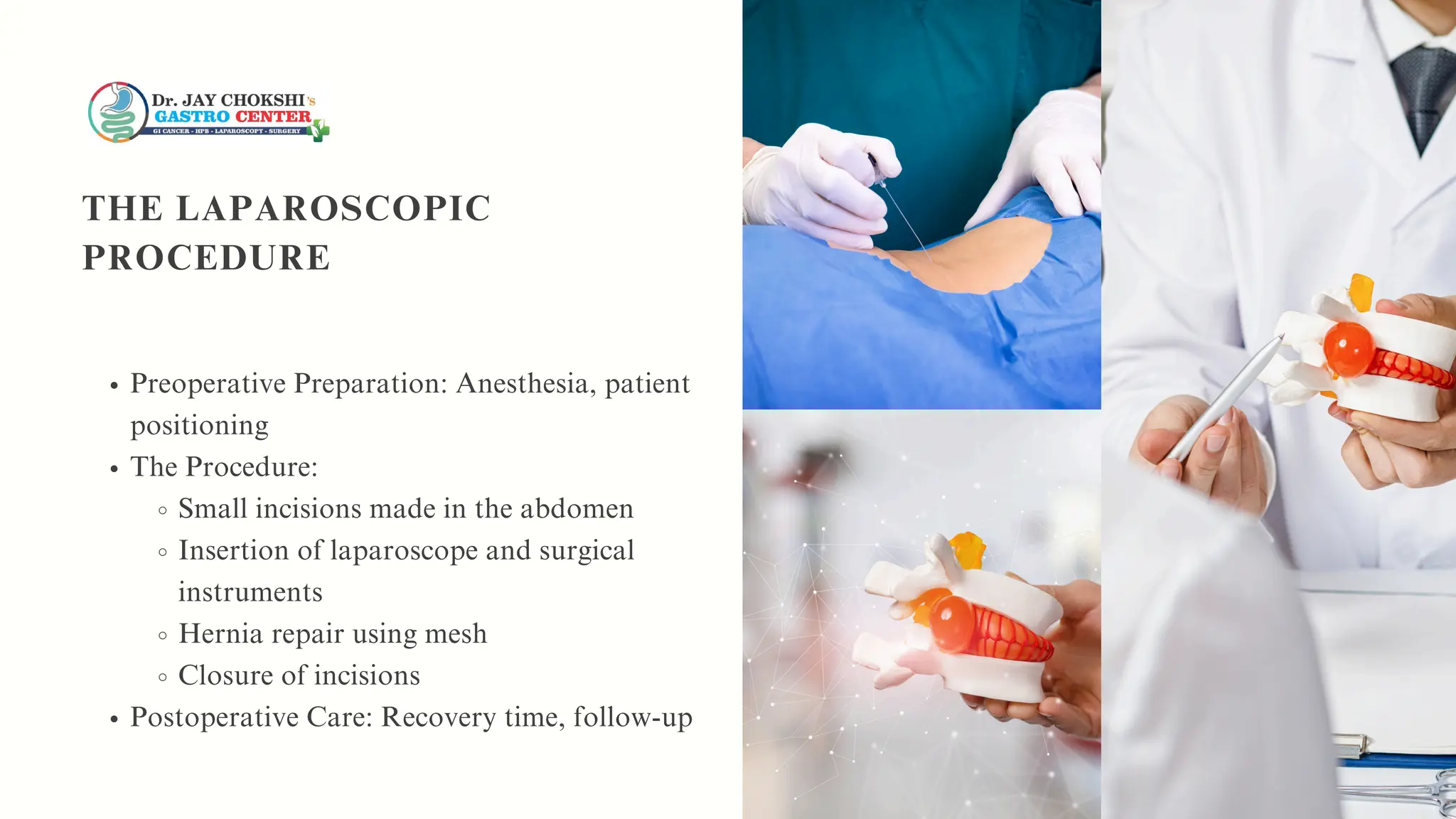 Overview on Advanced Laparoscopic Hernia Surgery | PDF