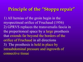 Laparoscopic Herniorrhaphy: TEP | PPT