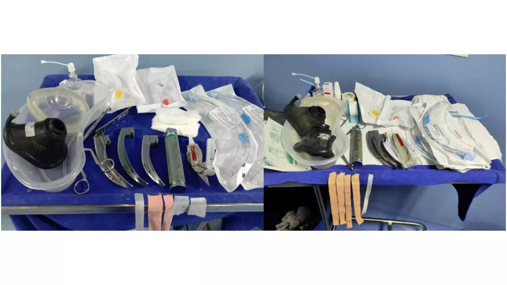 Laparoscopic inguinal hernia prep | PPTX