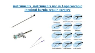 Laparoscopic inguinal hernia prep | PPTX