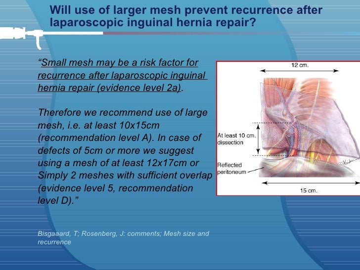 Laparoscopic Inguinal Hernia Repair Eminence-based or Evidence-based?