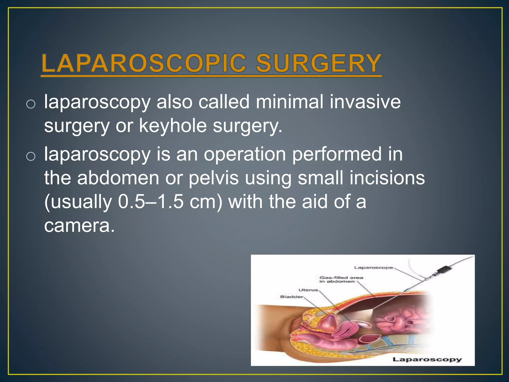 Laparoscopic instruments | PPTX
