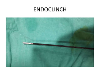 Laparoscopic instruments and Ergonomics | PPTX