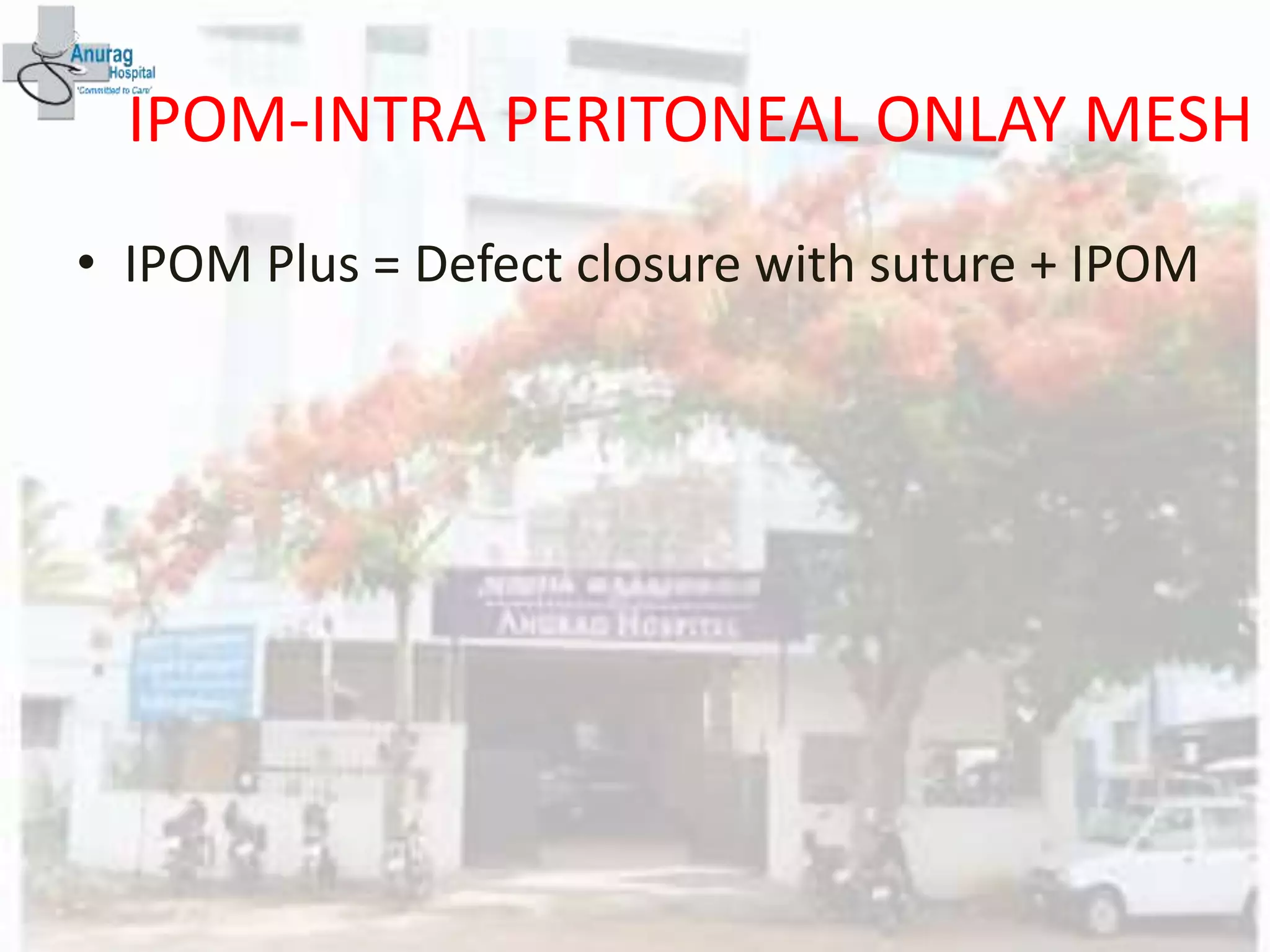 Laparoscopic ipom plus | PPTX