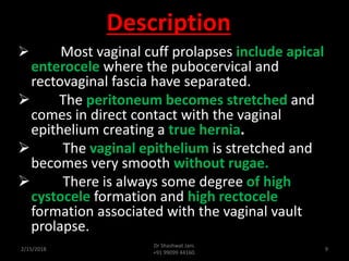 LAPAROSCOPIC MANAGEMENT OF VAULT PROLAPSE BY DR SHASHWAT JANI | PPTX