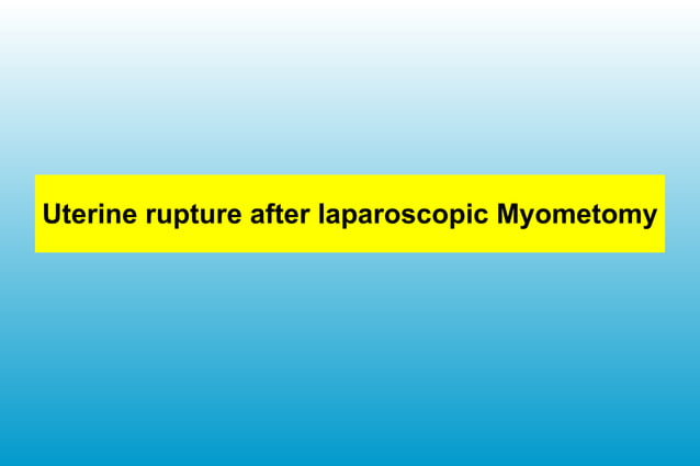 Endoscopic Management of uterine fibroids, Mob: 7289915430, www.drpradeepgarg.com, | PPT