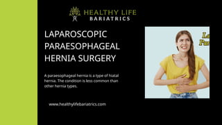 Laparoscopic Paraesophageal Hernia Surgery.pptx