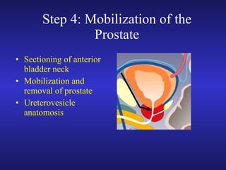 Laparoscopic Prostatectomy Intra- and Extraperitoneal Techniques | PPT