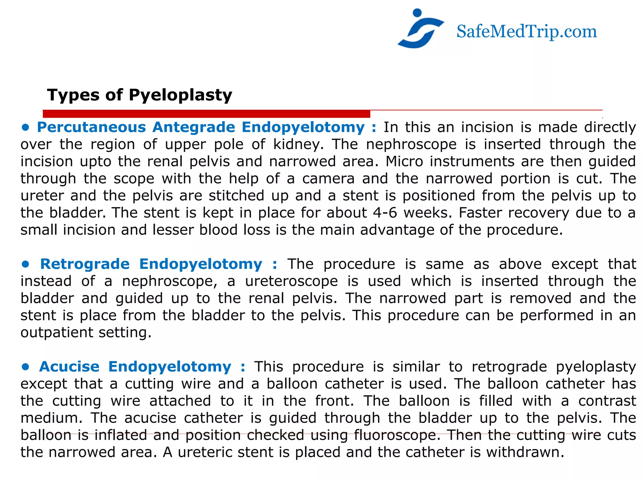 Highly Advanced Laparoscopic Pyeloplasty at World Class Hospitals in ...