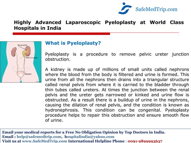 Highly Advanced Laparoscopic Pyeloplasty at World Class Hospitals in ...