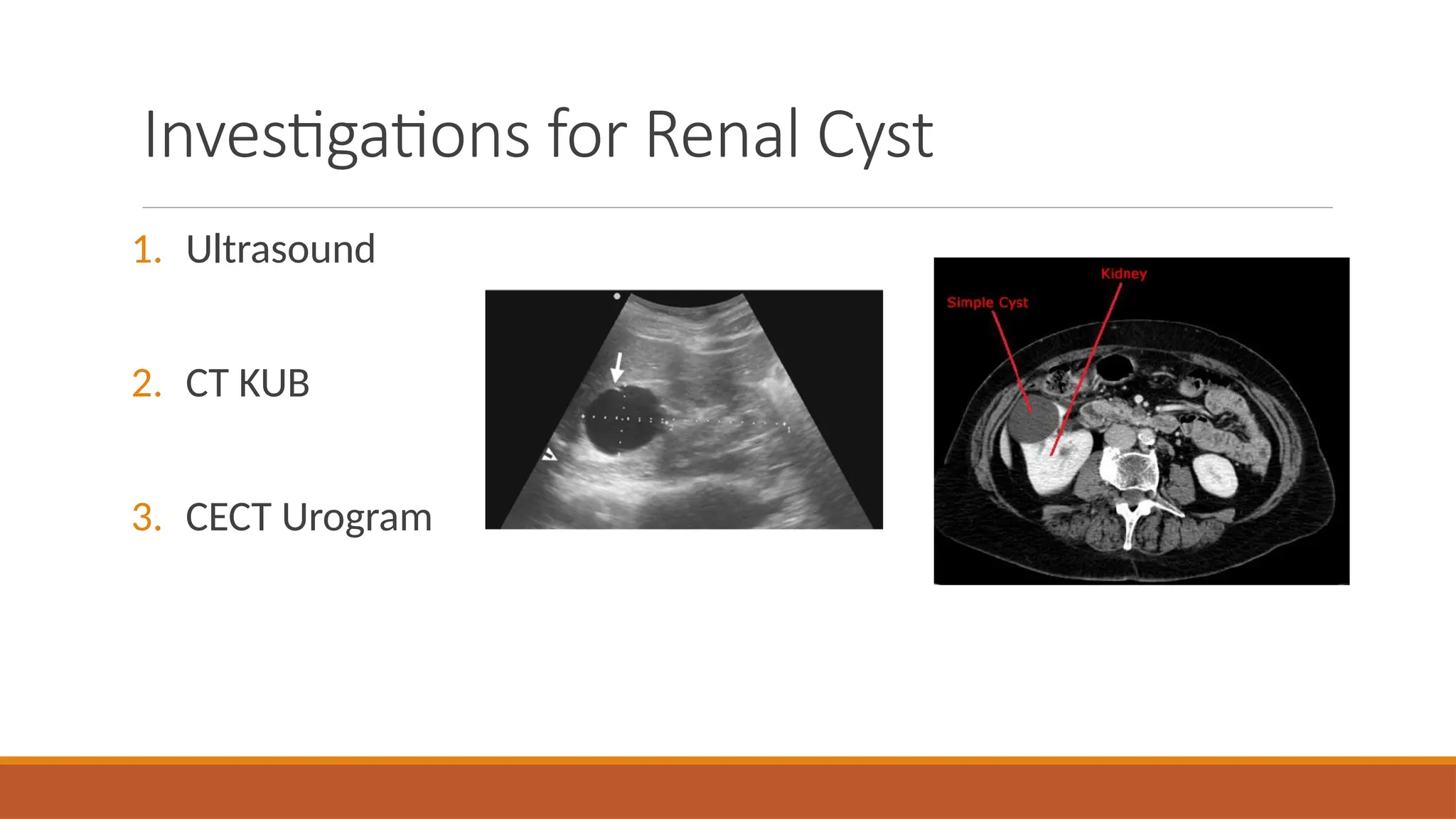 Laparoscopic Renal Cyst Deroofing for renal clear cyst | PPTX